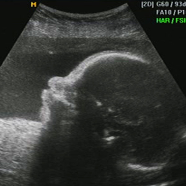 Elizabeth Harman’s James Franco Abortion Philosophy | National Review